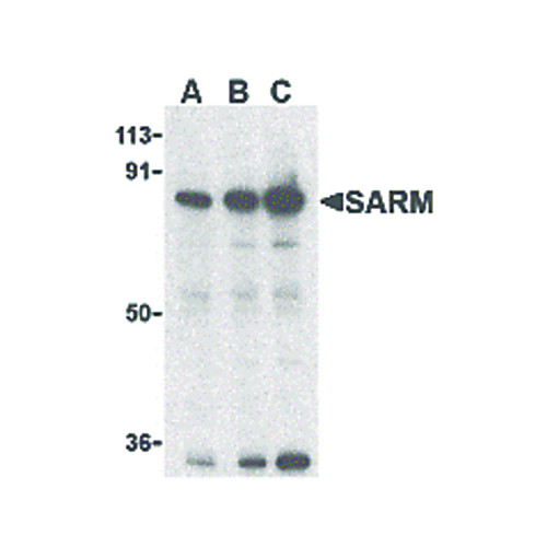 Anti-SARM (RABBIT) Antibody, 100µg, Liquid (sterile filtered)