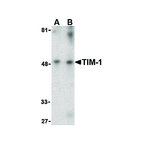 TIM-1 Antibody internal 100µg