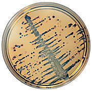 Chromagar Orientation at Thomas Scientific