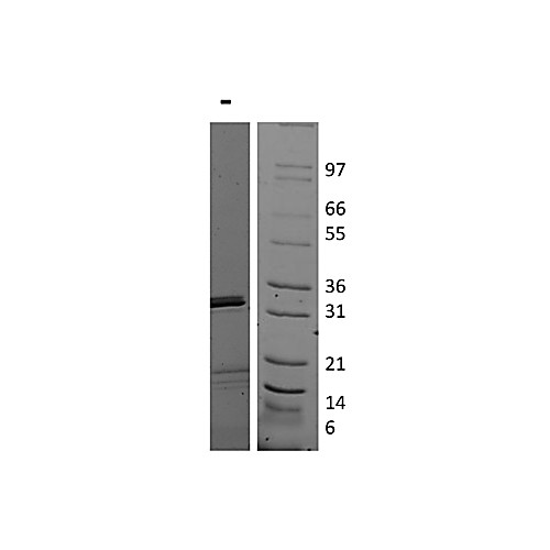 Human Interleukin-17E (IL-25) Recombinant Protein
