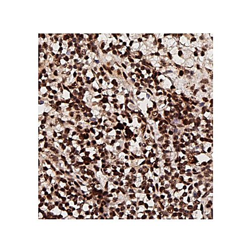 Anti-AKT pT308 (RABBIT) Antibody