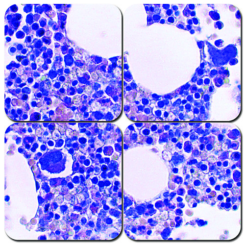 Optimized Giemsa Stain Kit, Pint