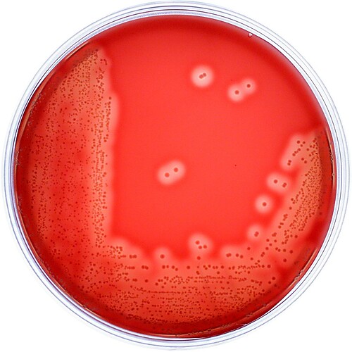 GBS Detect, for non-hemolytic Group B Strep, Reduced Stacking Ring (RSR)