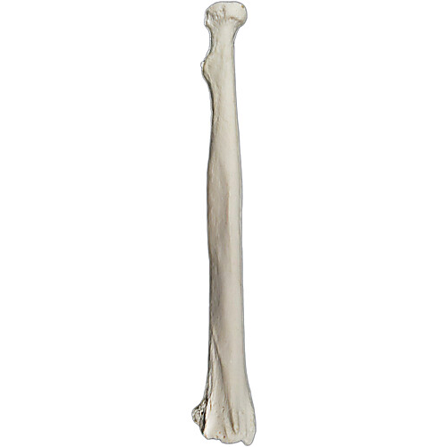 Radius Bone Model
