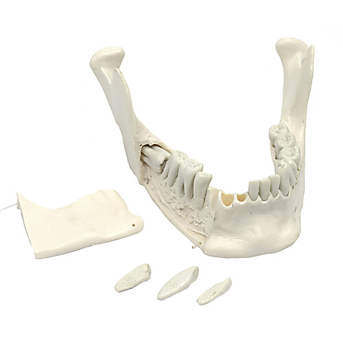Lower Jaw Bone Model with Extractable Teeth