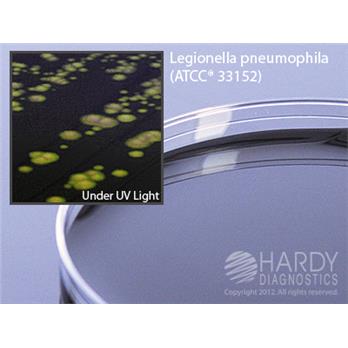 BCYE Agar (Buffered Charcoal Yeast Extract)