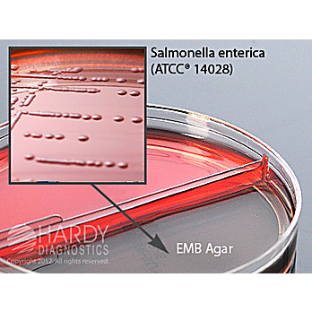 Blood Agar, 5%/EMB Agar Biplate