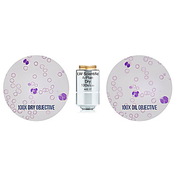 100x Infinity Plan DRY Objective