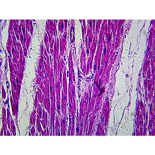 Prepared Microscope Slide,Myocardial Infarct Section