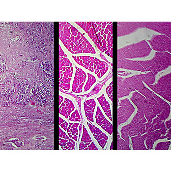Prepared Microscope Slide,Muscles, Smooth,Cardiac, Striated
