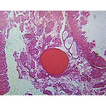 Prepared Microscope Slide,Earthworm, Composite, C.S. Section through ...