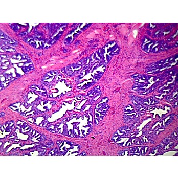 Prepared Microscope Slide,Prostate Section Glandular Epithelium