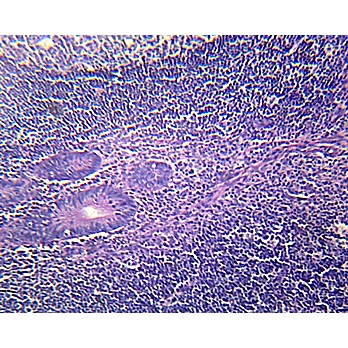 Prepared Microscope Slide,Vermiform Appendix Section