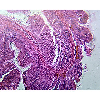 Prepared Microscope Slide,Earthworm, Composite, C.S. Section through ...