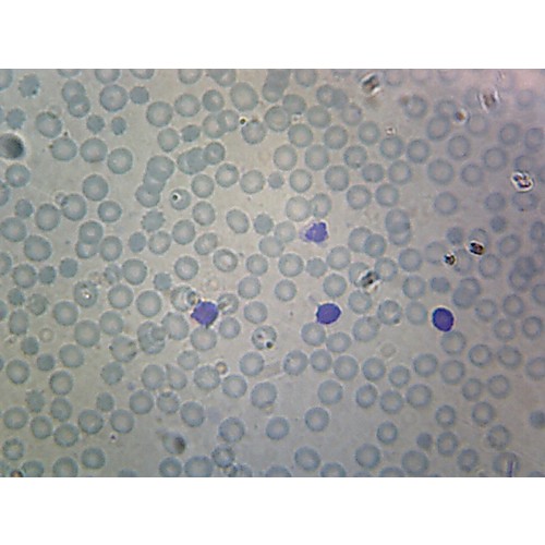Prepared Microscope Slide,Blood Smear WR Stain Human