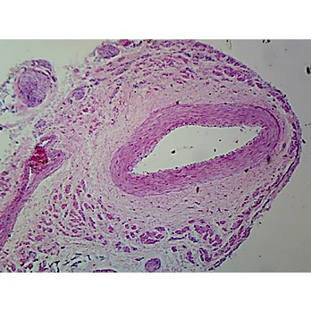 Prepared Microscope Slide,Medium Sized Artery and Vein